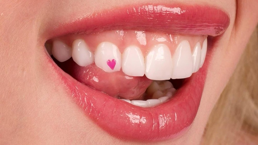 Piercing no dente está na moda de novo e tendência traz riscos e ...