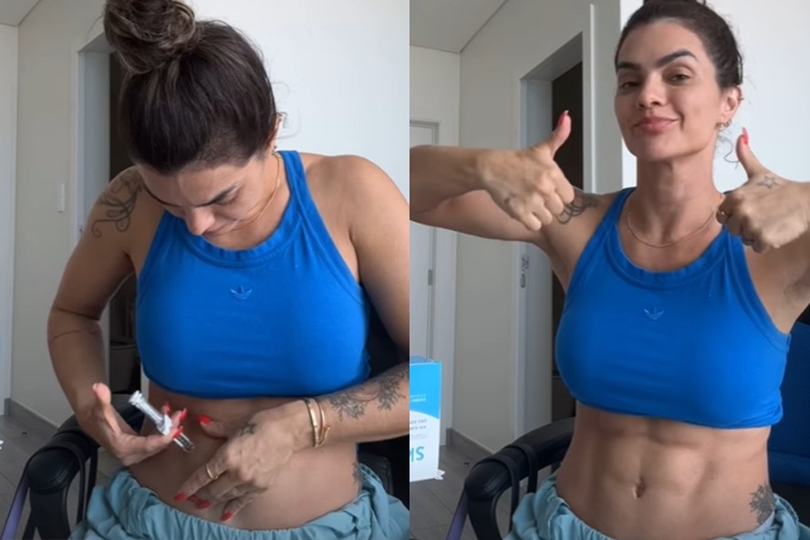 Kelly Key desabafa sobre psoríase, doença autoimune: 'Há dias difíceis ...