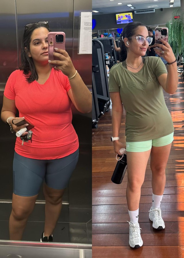 Relatos de quem tomou Mounjaro: o que dizem brasileiras que usaram o ...