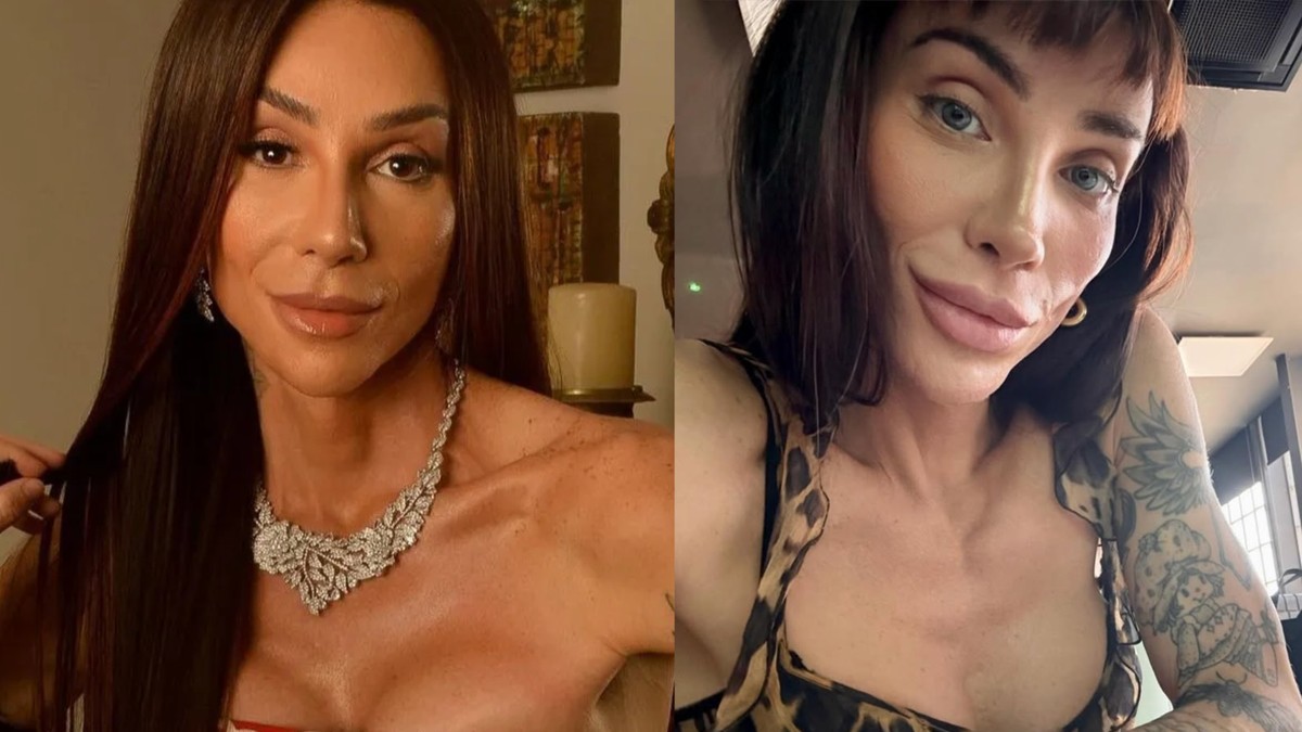 Maya Massafera muda cor dos olhos em cirurgia; oftalmologista explica ...