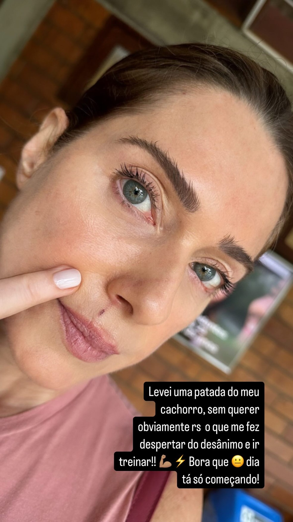 Leticia Spiller mostra rosto machucado por patada de cachorro: 'Sem querer'