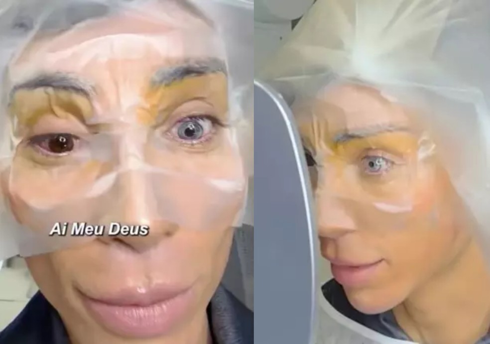 Maya Massafera muda cor dos olhos em cirurgia; oftalmologista explica ...