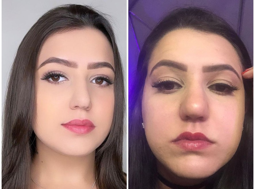 'Tomei omeprazol, comecei a sentir meu rosto pegando fogo, muito ...