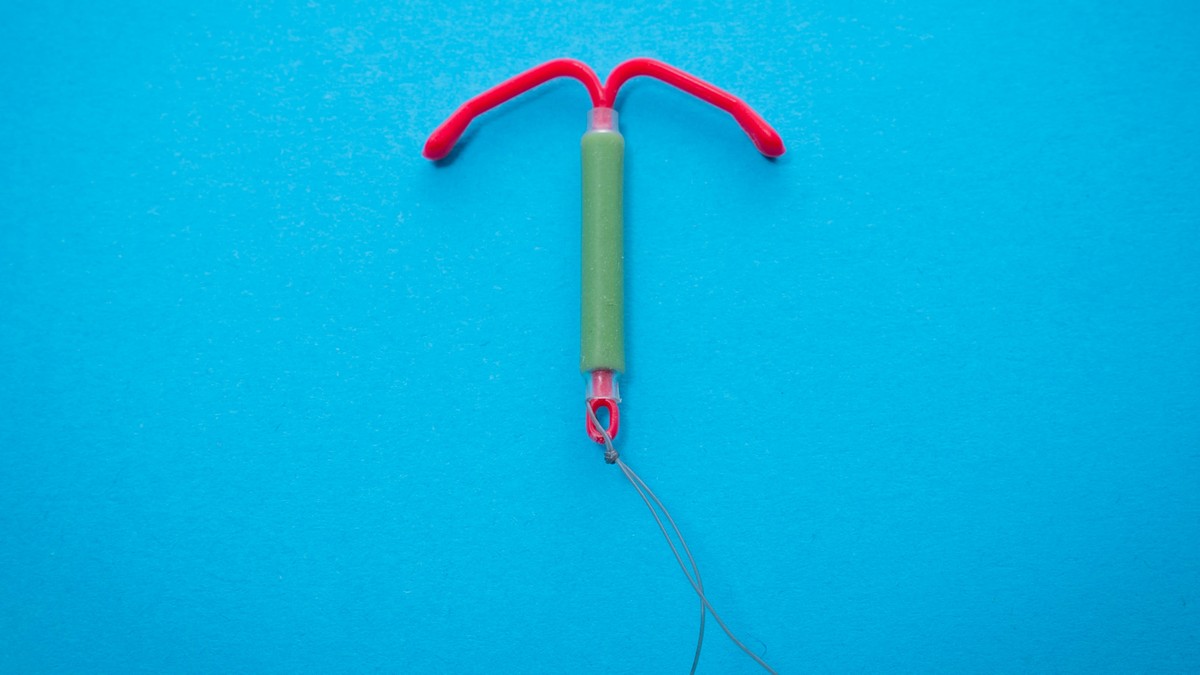 DIU: É preciso fazer repouso depois de retirar o dispositivo intrauterino?