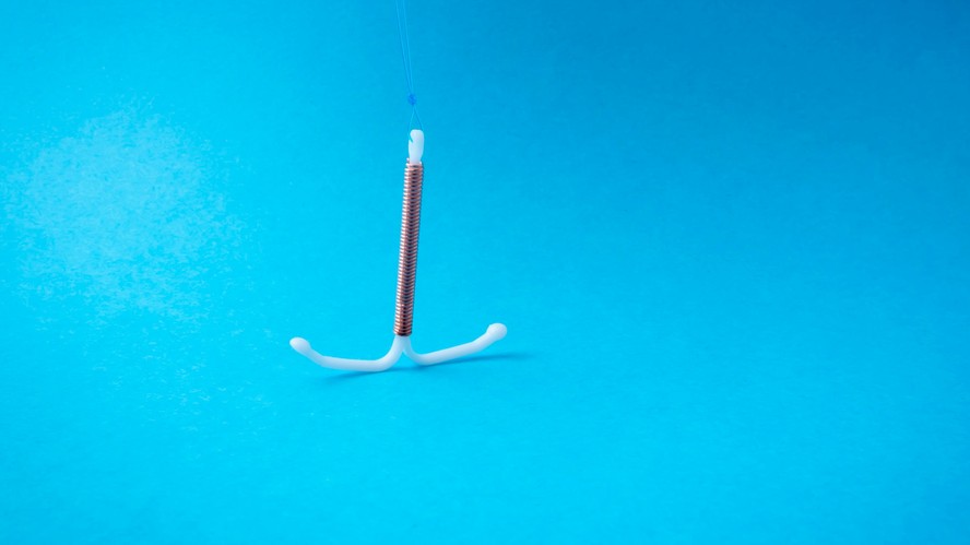 DIU de cobre: como funciona e quanto dura o dispositivo intrauterino ...