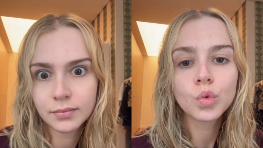 Isa Scherer mostra resultado de botox na boca e revela que lábios ...