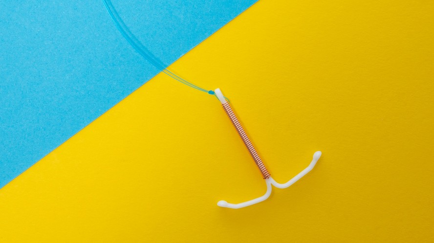 Quanto tempo dura o DIU?