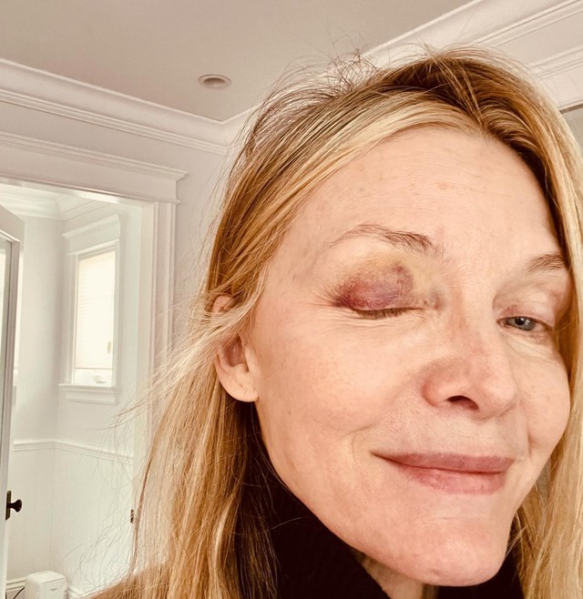 Michelle Pfeiffer se machuca e brinca: 'Pickleball, fique longe da ...