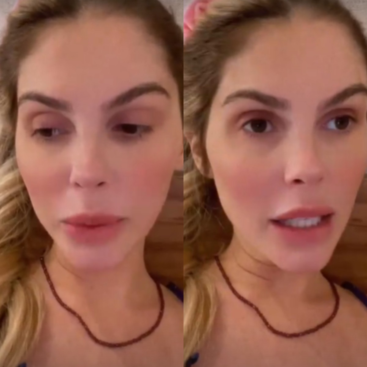 Bárbara Evans diz que precisou operar hemorroidas às pressas depois do ...