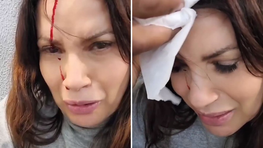 Abalada, Isadora Ribeiro faz alerta aos fãs após sofrer acidente ...