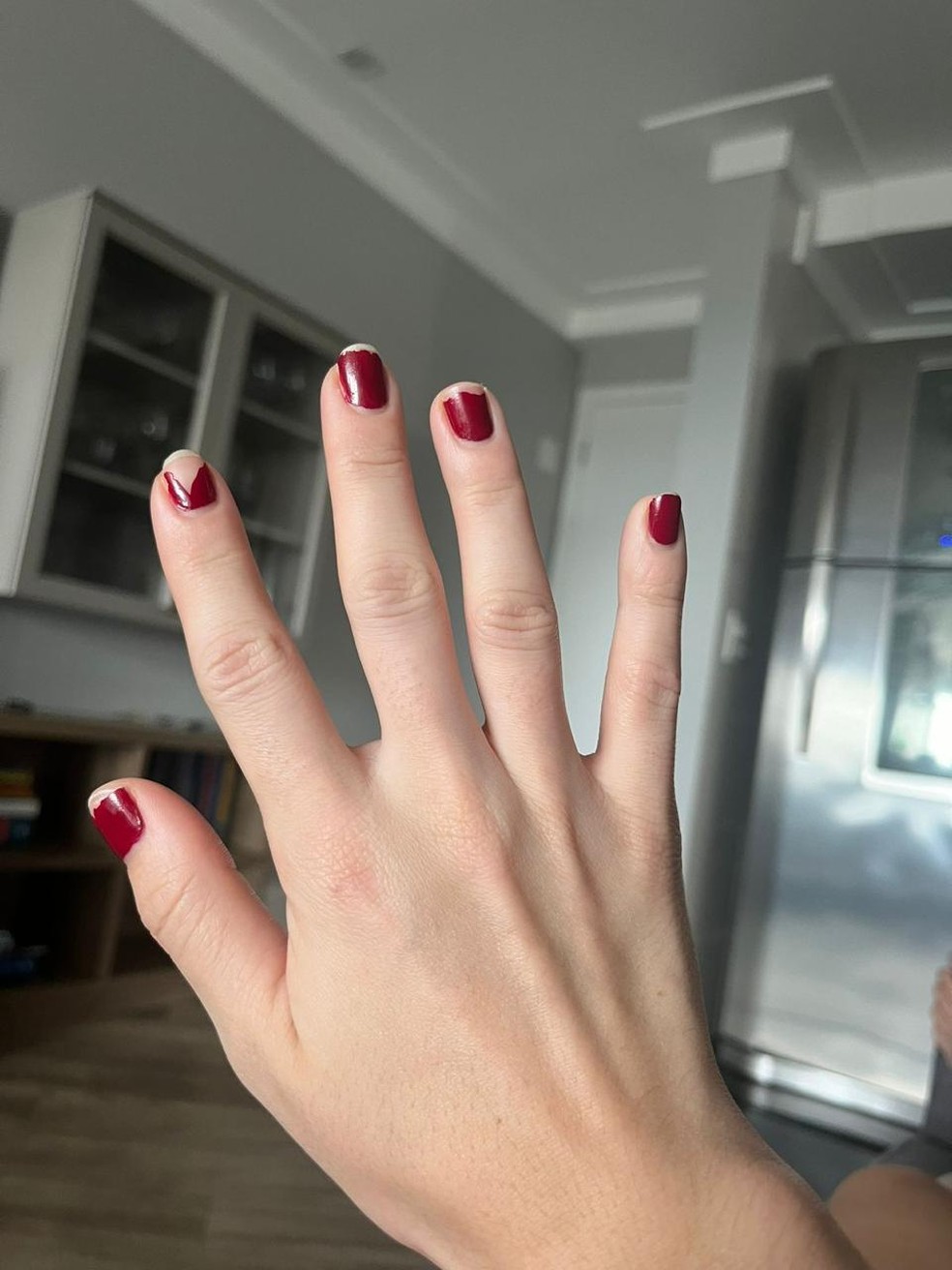 ‘Desenvolvi uma doença autoimune e um nódulo no seio depois de colocar ...