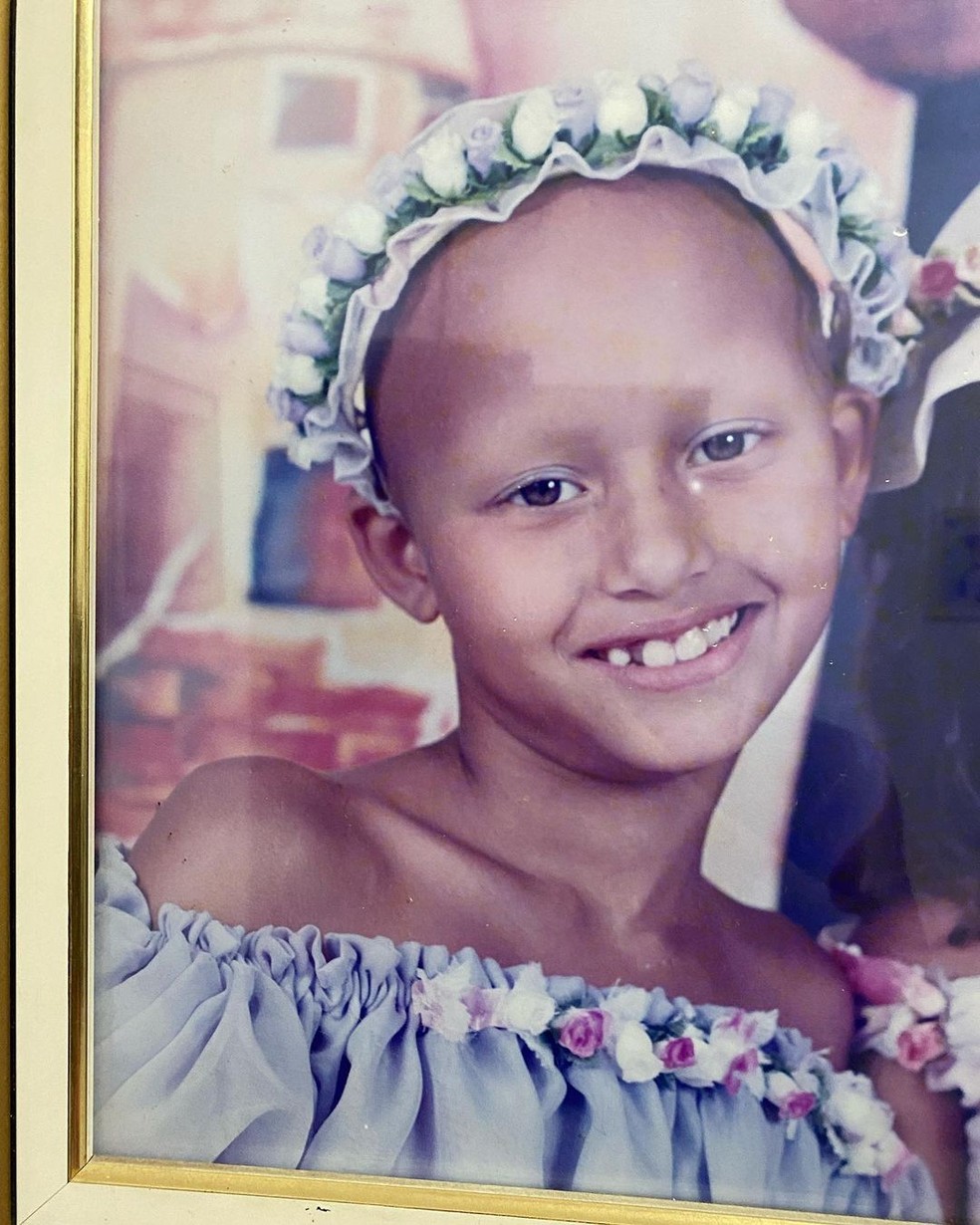 Modelo com alopecia usa a internet para desmistificar a doença: ‘Acham ...