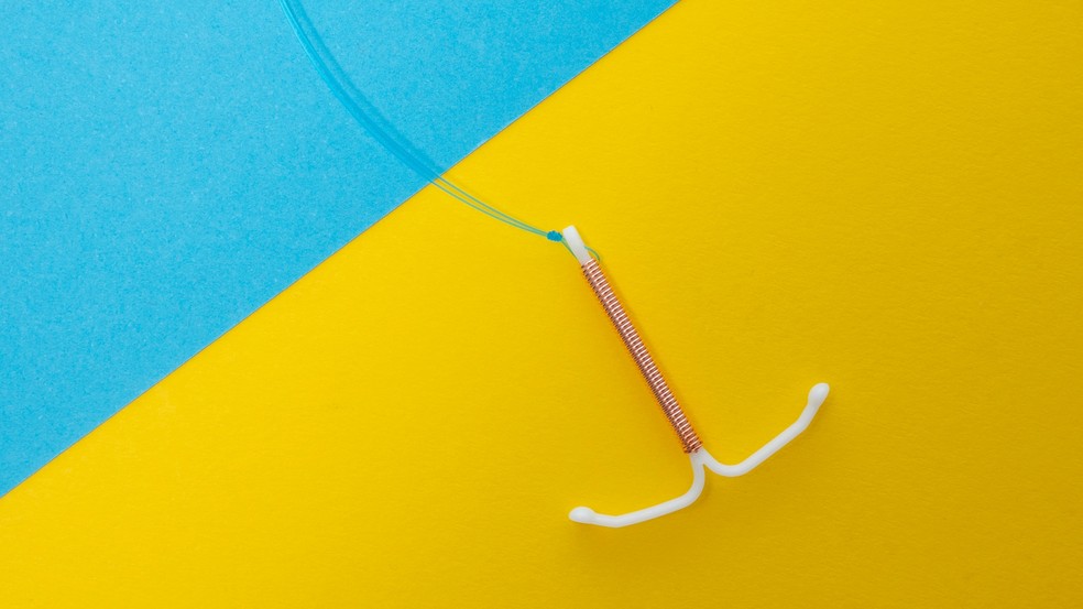 Imagens de DIU: como é o dispositivo intrauterino