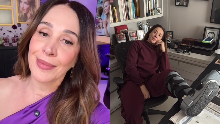 Claudia Raia fratura tornozelo durante peça e cancela apresentações no ...