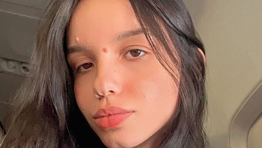 'Minha mãe tomou Roacutan grávida e eu nasci com várias sequelas'