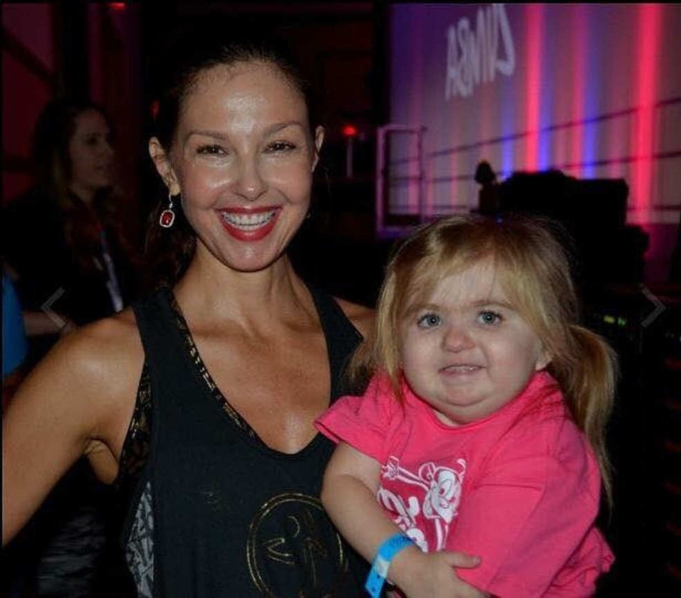 Por onde anda Audrey Nethery, a garotinha com doença rara que viralizou ...