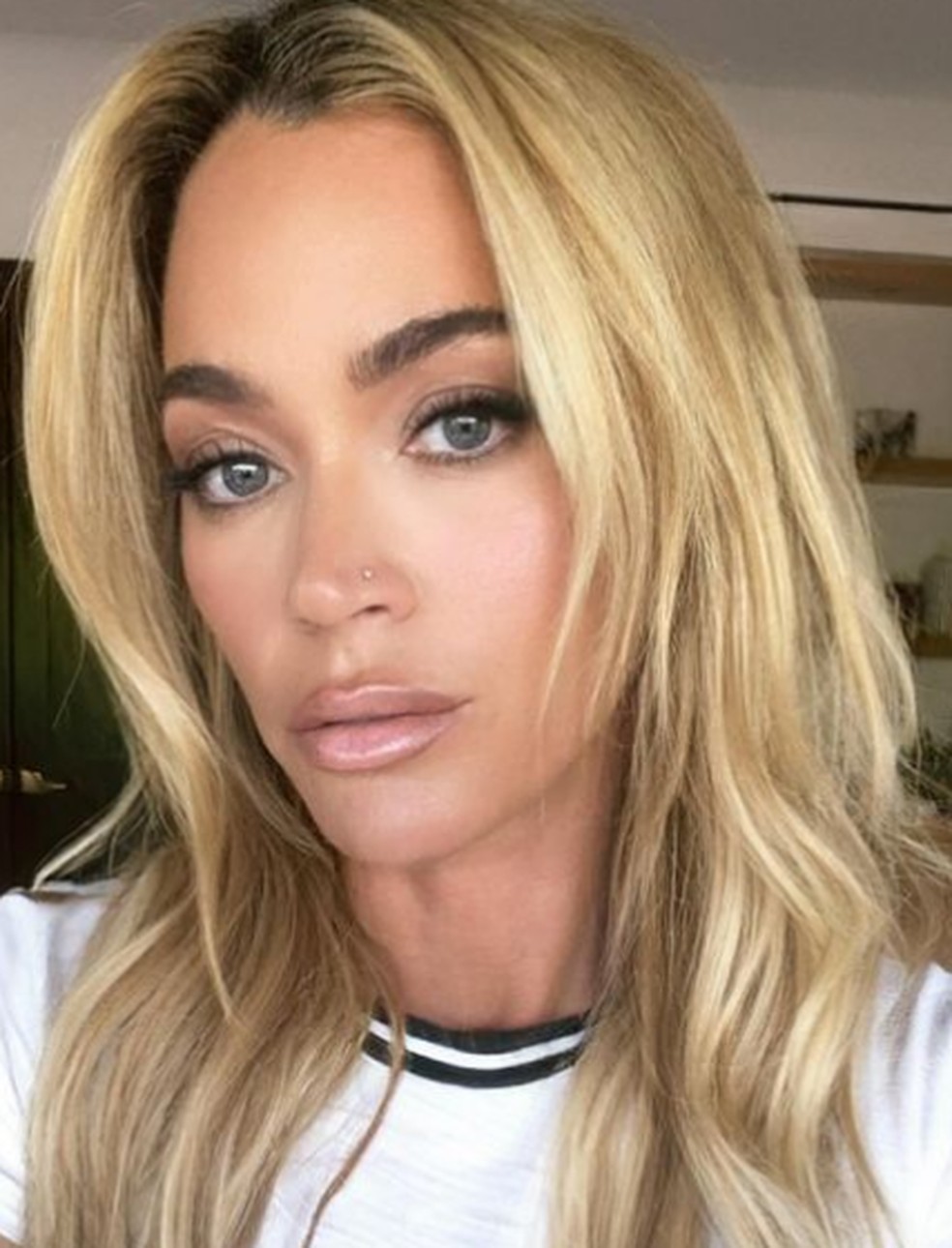 Estrela de reality show desabafa após remoção do 16º melanoma: 'Sempre ...
