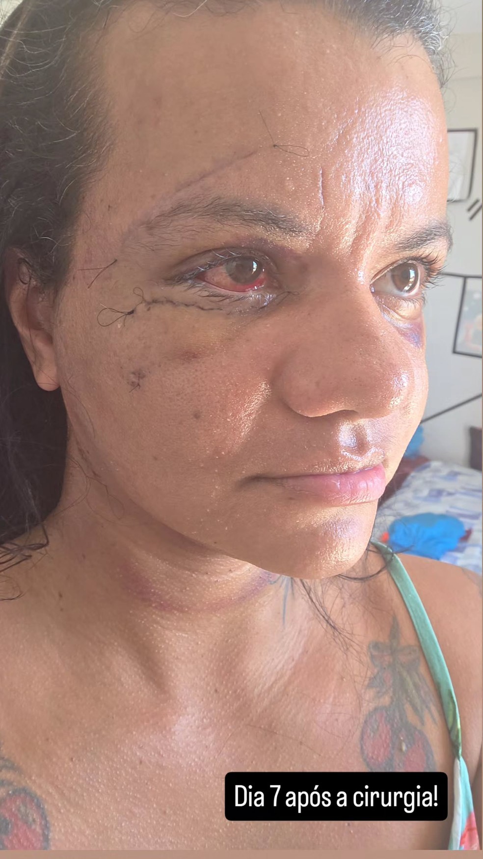 Juliana dos Santos, agredida com 61 socos em elevador, mostra como está seu rosto 7 dias após ...