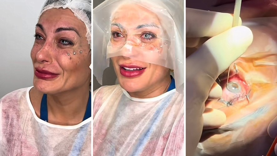 Andressa Urach se arrepende de mudar a cor dos olhos, mas clínica ...