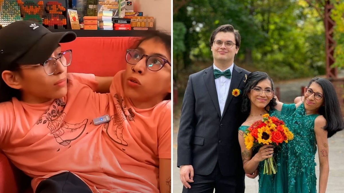 Gêmea siamesa Carmen Andrade explica como vive casamento e irmã brinca ...