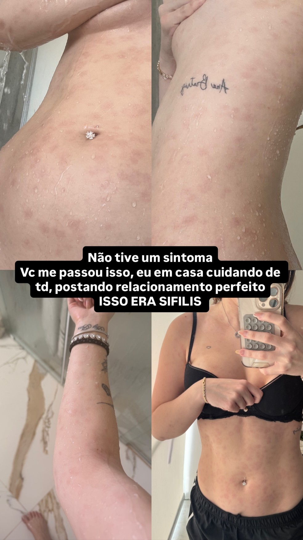 Influenciadora Isabelli Mafra diz que contraiu sífilis durante namoro com ex-namorado: 'Me ...