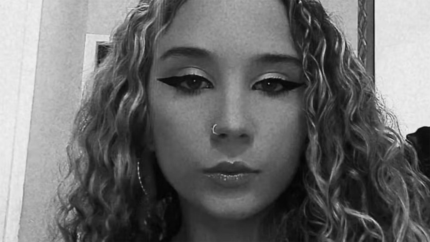 O que é Saco de Douglas e o que pode causar a ruptura dessa parte do ...