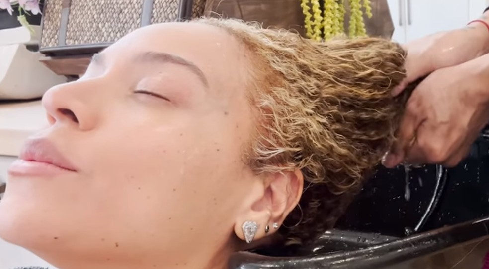 Após revelar batalha contra a psoríase, Beyoncé mostra seu cabelo real ...