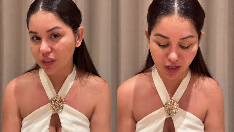 Mulher de sertanejo expõe que foi agredida por ex-companheira de seu marido: 'Temo pela minha vida'