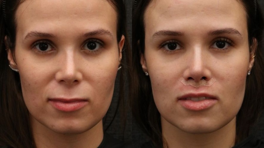 Dois meses após viralizar, Jennifer Castro, a mulher do avião, passa ...