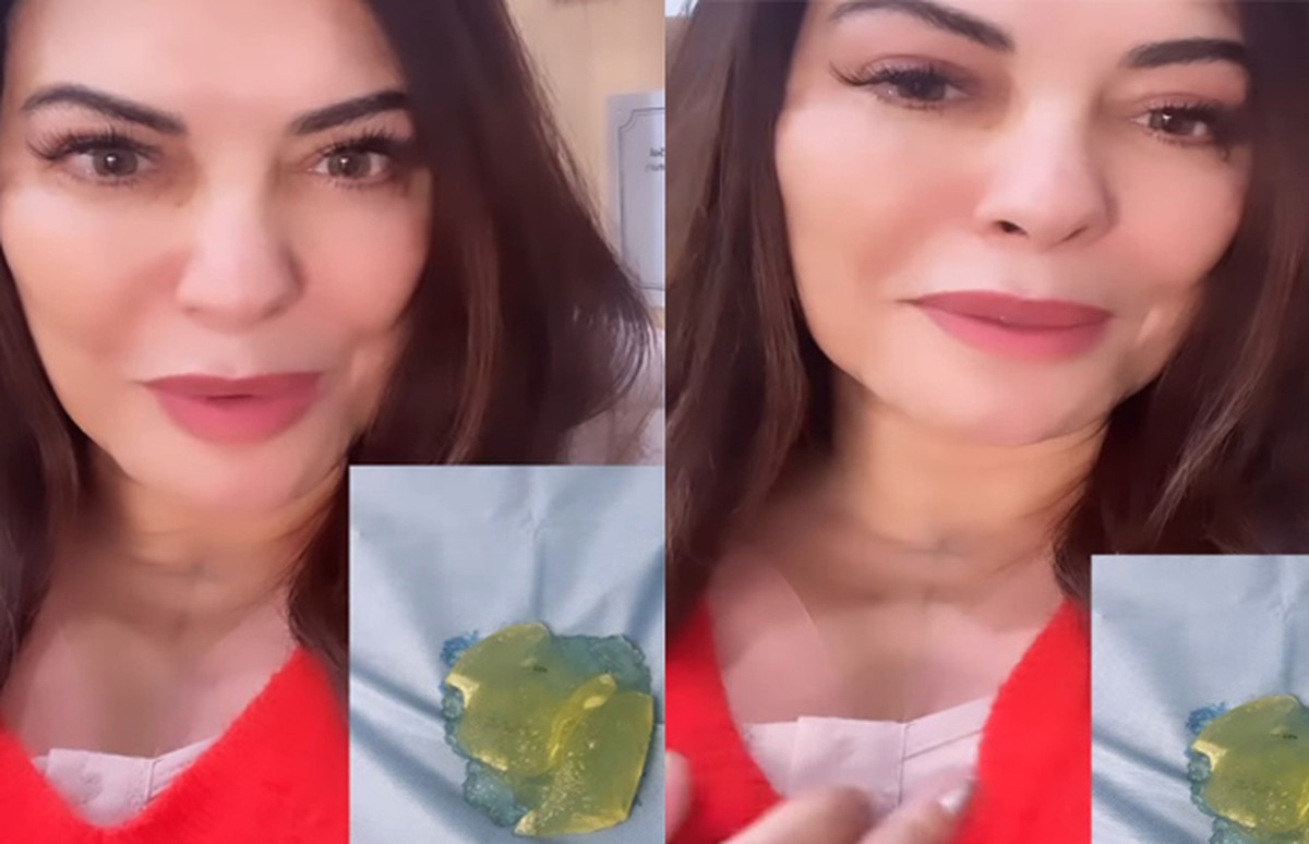 Márcia Goldschmidt faz alerta após cirurgia 'delicada': 'Mulheres, cuidem-se'