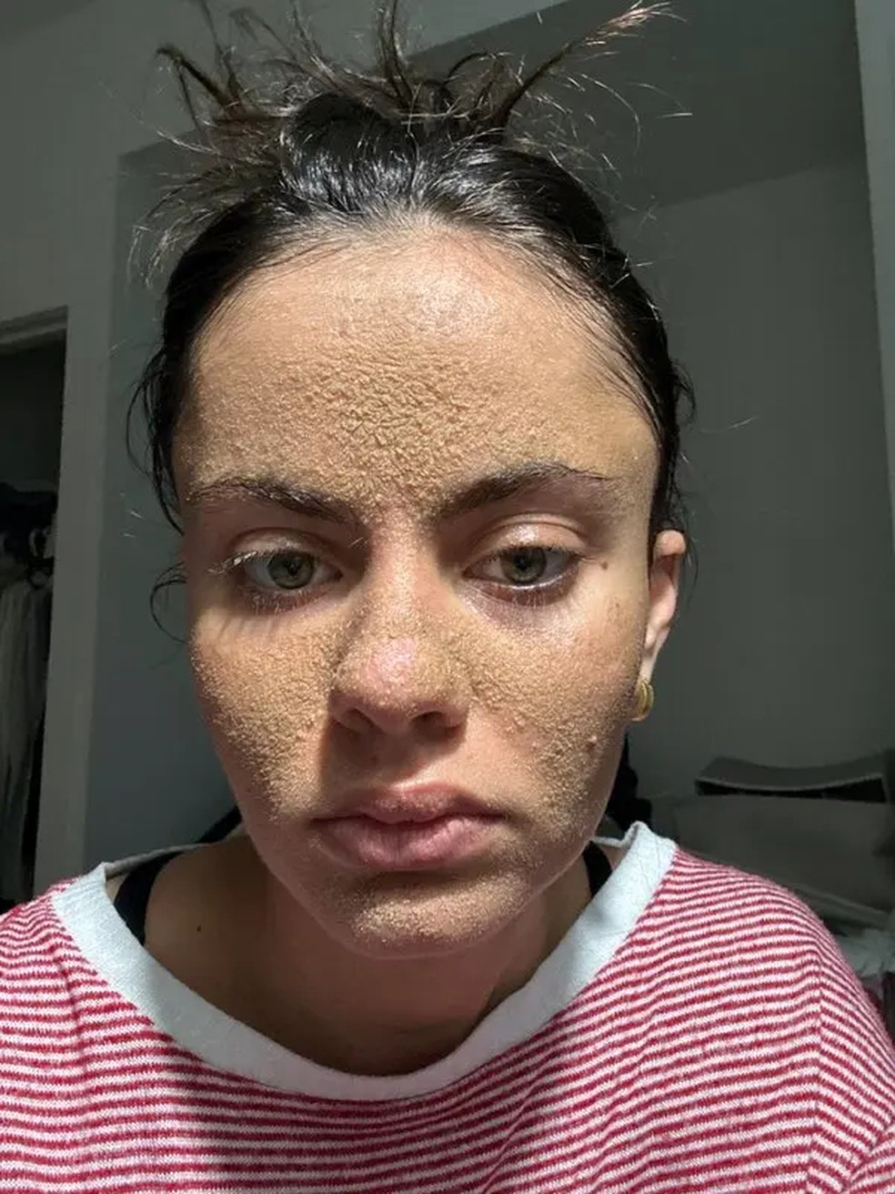 Skincare do 'homem das cavernas' causa riscos à pele? Especialistas ...
