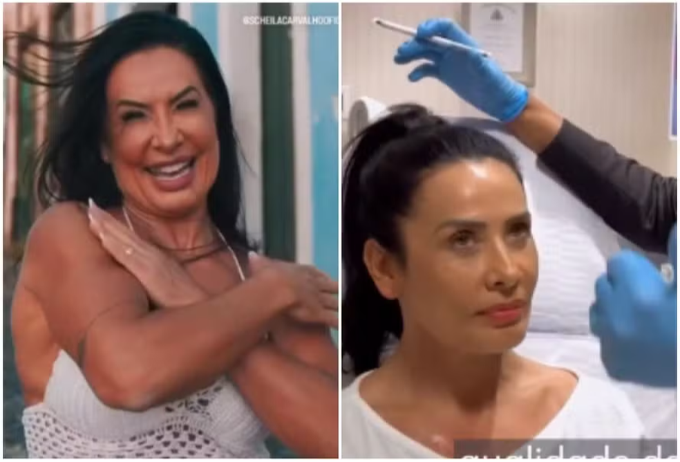 Scheila Carvalho, Gabi Martins, Carolina Dieckmann: o antes e depois ...